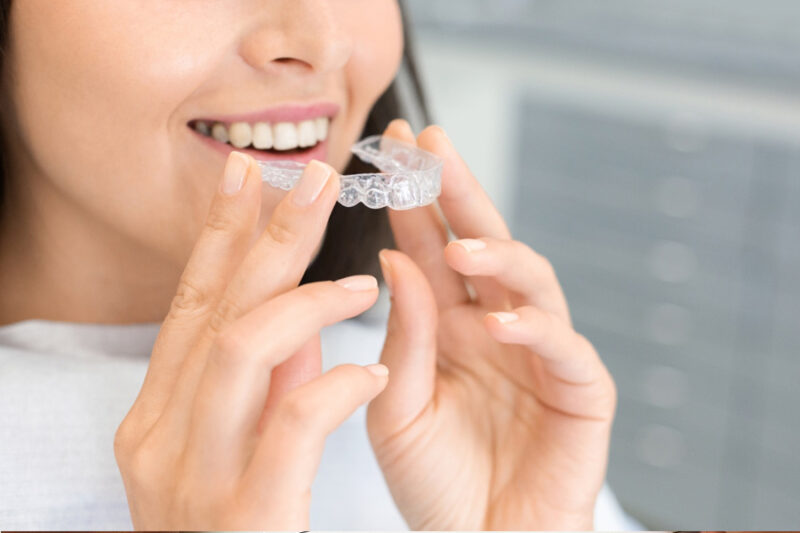 Clear Confidence in Kelowna: How Invisalign and Skilled Orthodontists ...